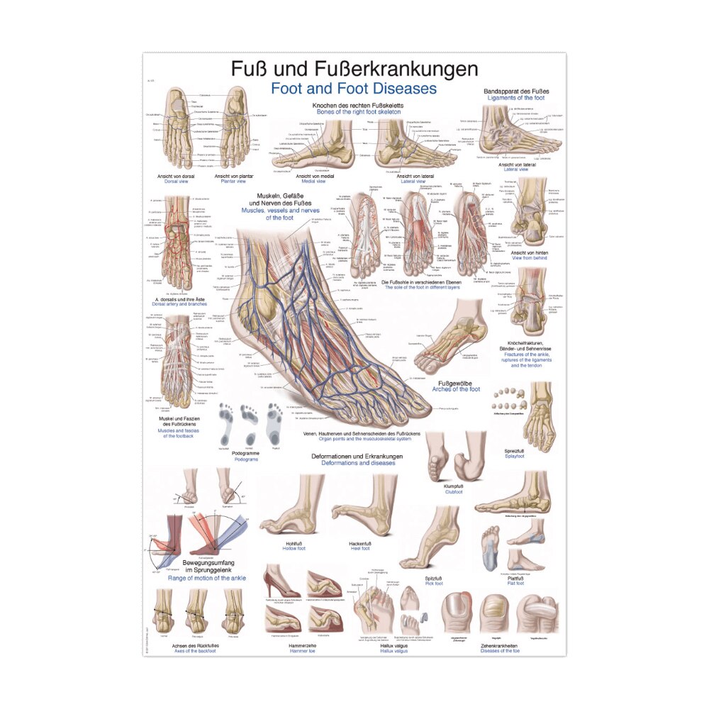 Erler-Zimmer Lehrtafel "Fuß und Fußerkrankungen" | 2 Formate