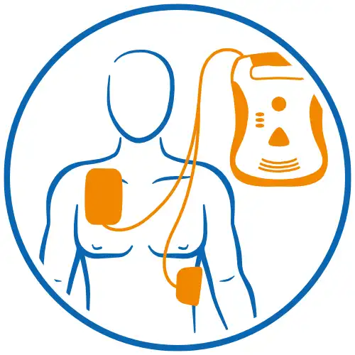 Defi Pads kleben - Anleitung & Tipps | medplus-Ratgeber