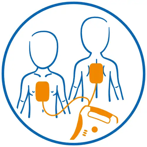 Defi Pads kleben - Anleitung & Tipps | medplus-Ratgeber